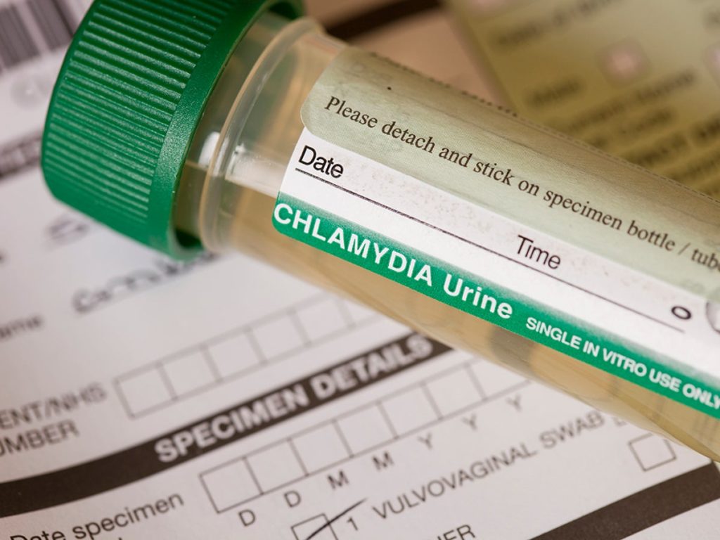 Decision to only test women for chlamydia is ‘disaster’, leading sexual ...